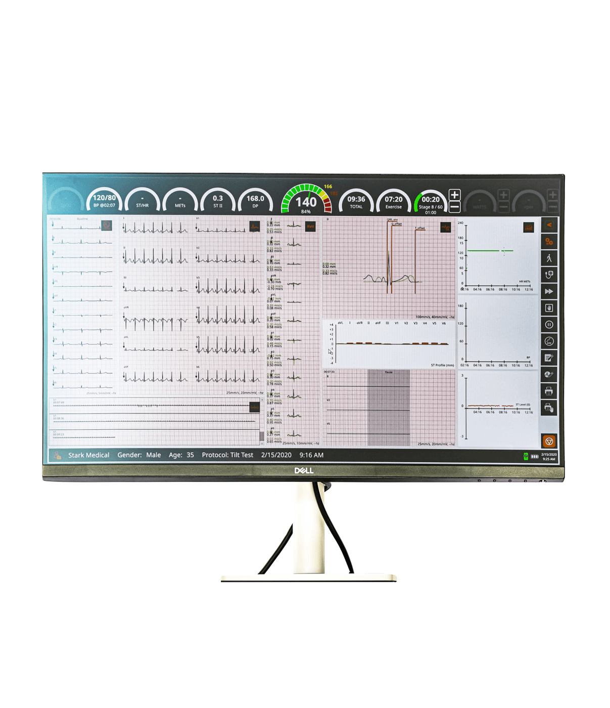 Cardioline Cubestress ECG System — Stark Medical Pty Ltd